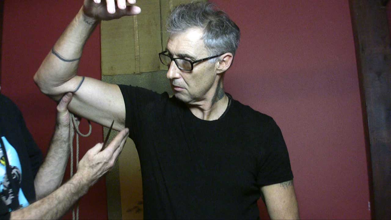 A test for radial nerve sensitivity - ESINEM.com